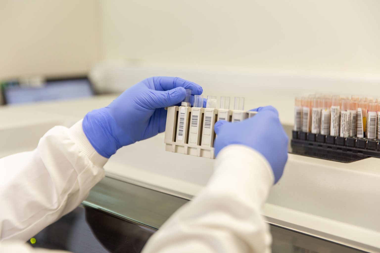 Laboratorio Clínico - Clínica Andes Salud Chillán