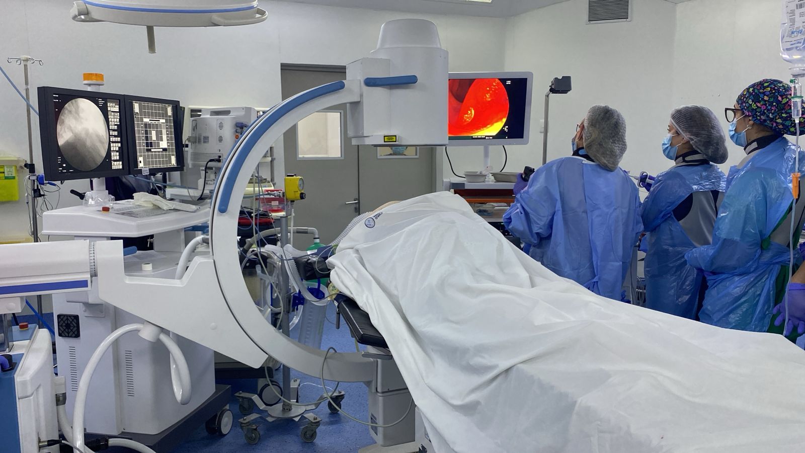 PRIMERA COLANGIOPANCREATOGRAFÍA RETRÓGRADA ENDOSCÓPICA (CPRE) EN ...